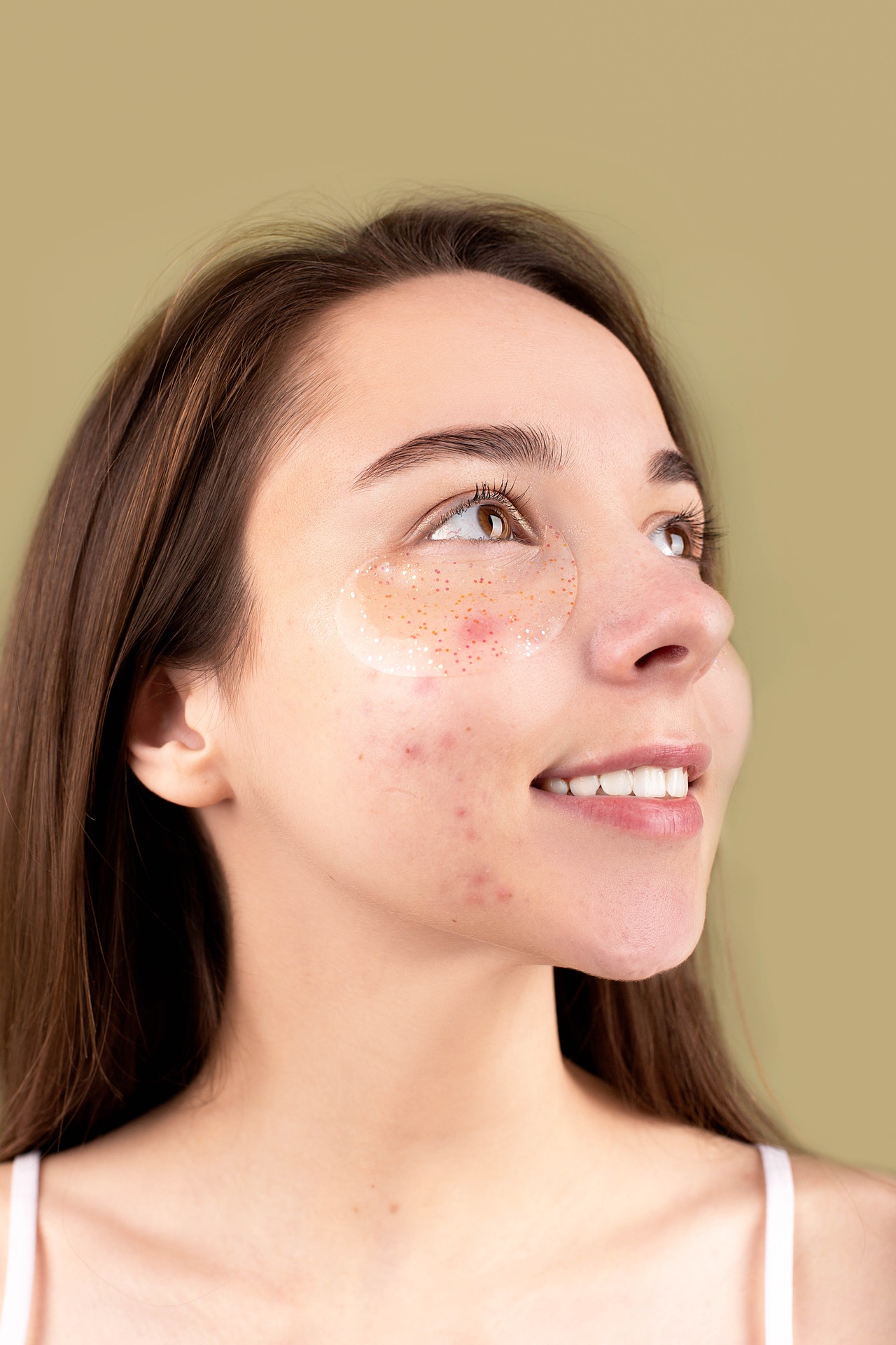 5 Rekomendasi Acne Patch Terbaik Untuk Serap Jerawat - Scarf Media
